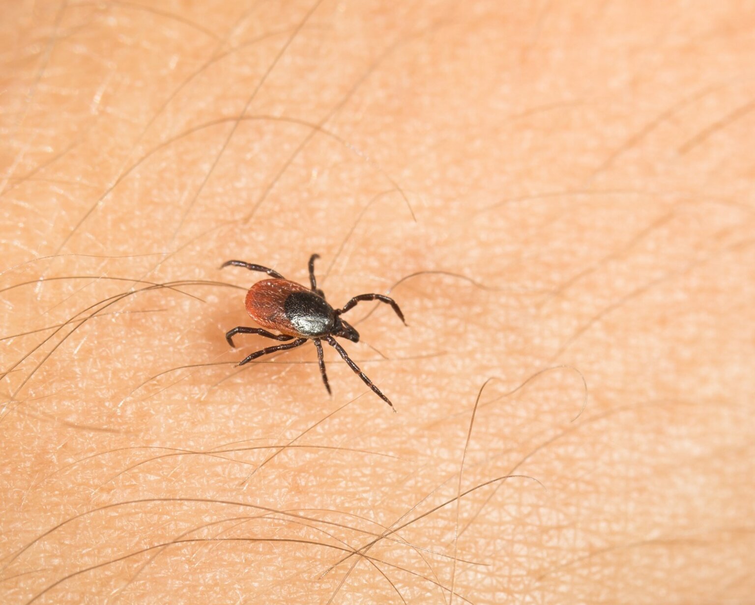 Tick Prevention Tips for Families: Stay Safe This Summer